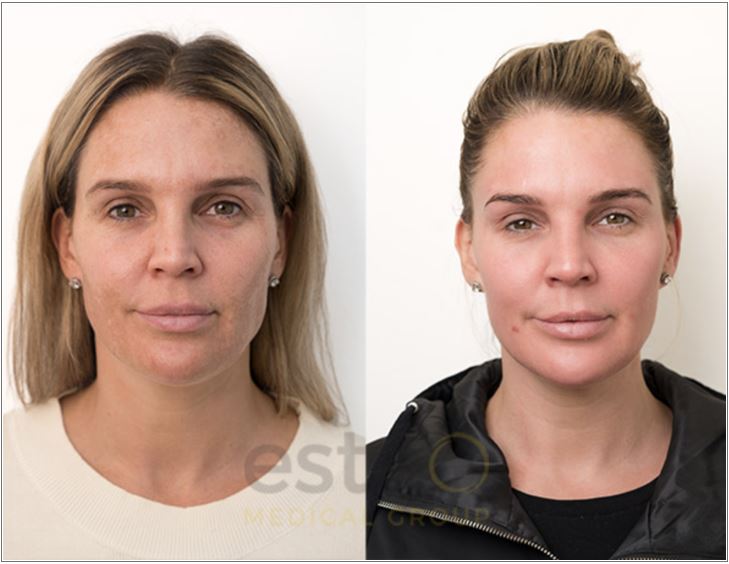 Dubai Beauty Guide: Secrets to Healthy Skin in the UAE - Dubai Blog